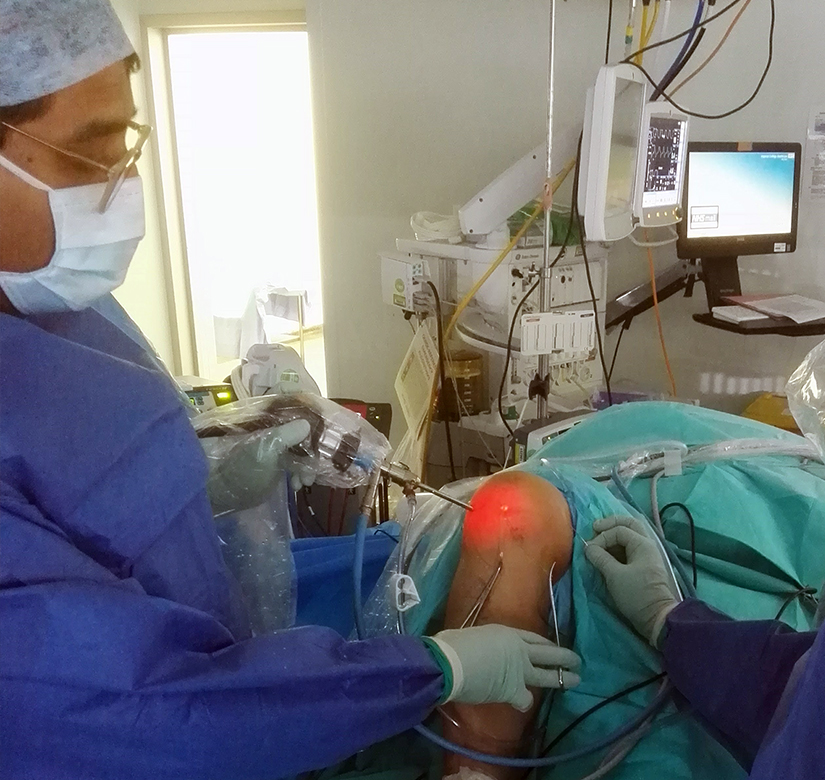 Soft Tissue Surgery | Surgery for Meniscal Injuries | London Orthopaedics